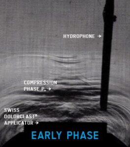 Shockwave Therapy Device- Swiss DolorClast Method | Magne-tec
